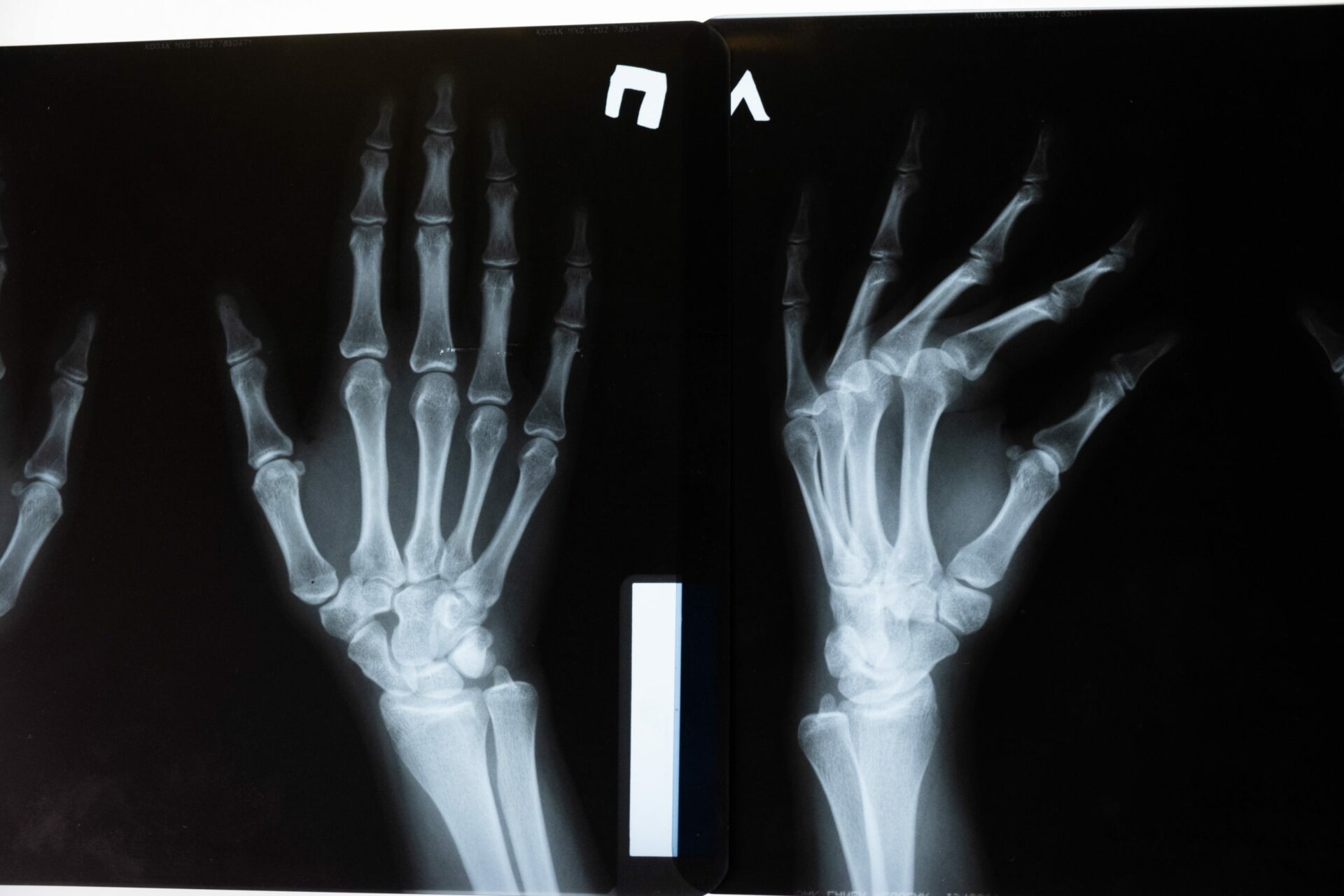 Our Most Common Hand Conditions | Michigan Surgery Specialists