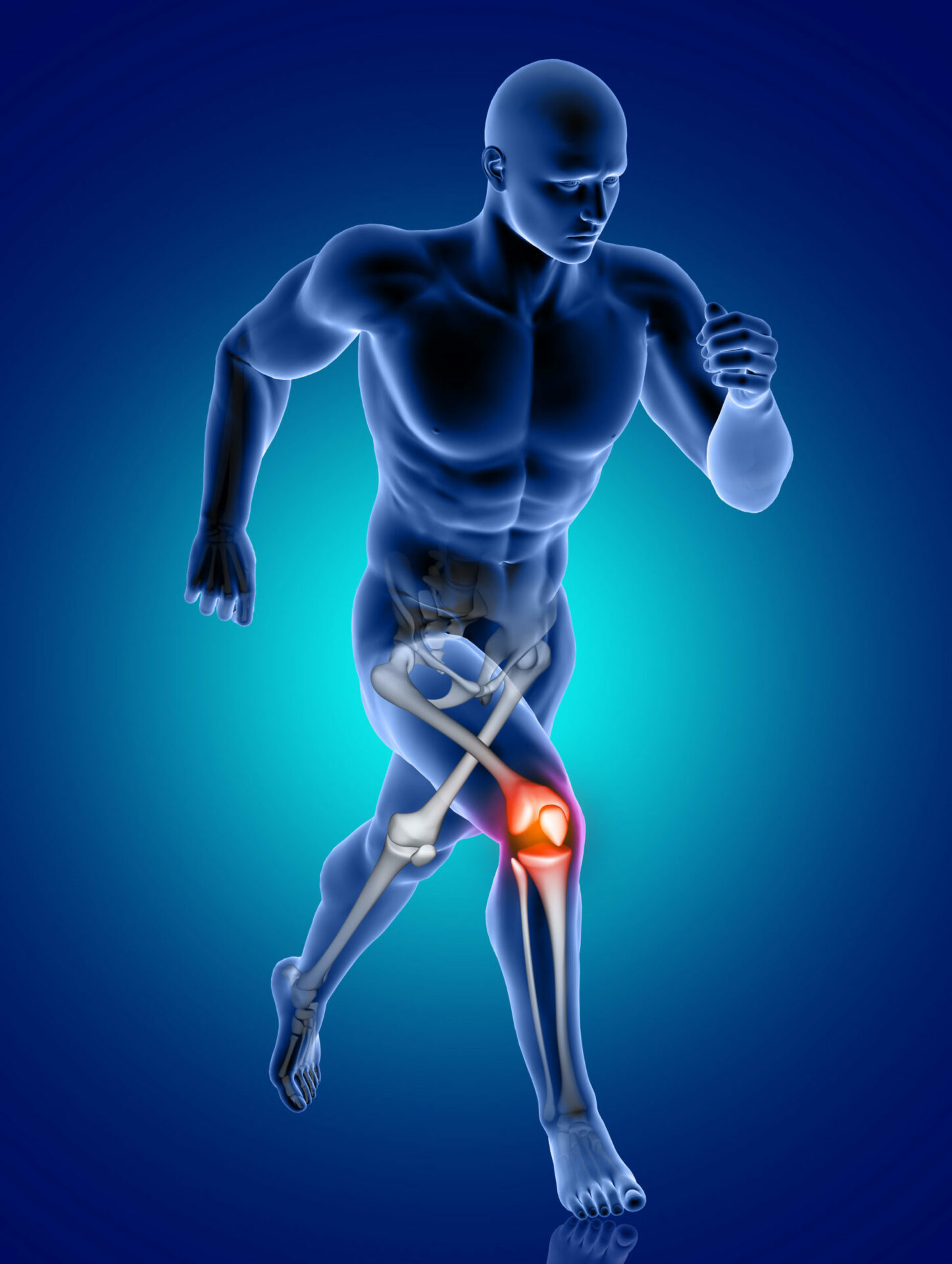 ACL Injuries | Michigan Surgery Specialists